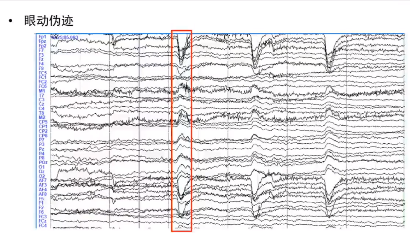 EEGLAB脑电信号预处理1基本流程